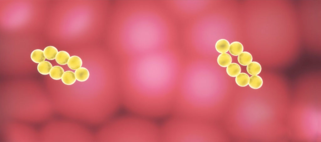 Pulse MED - Euphrates Vascular